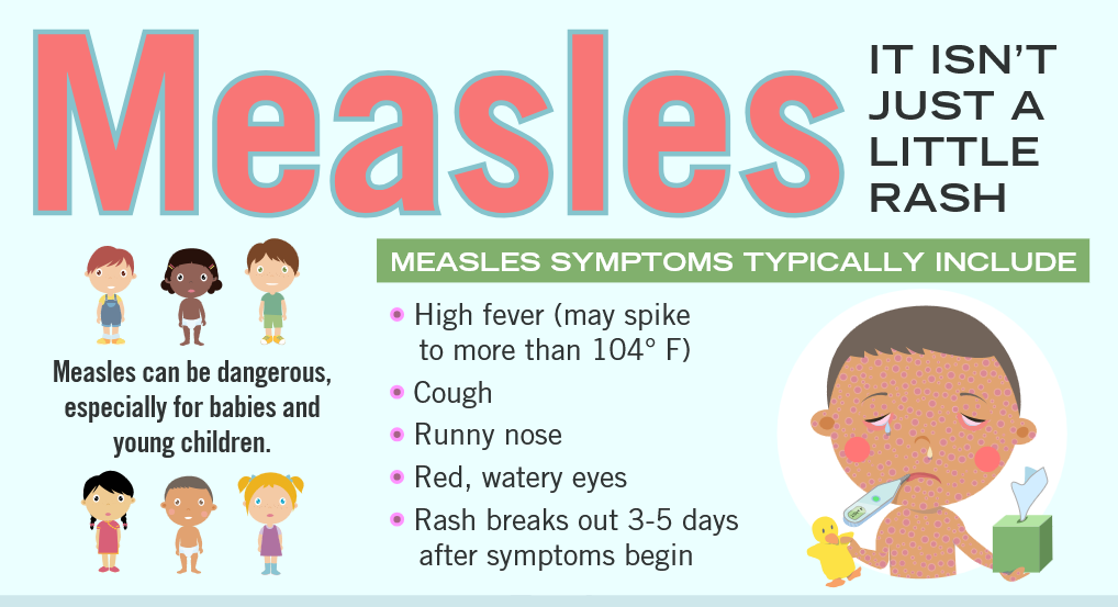 Measles (Rubeola) | South Carolina Department of Public Health